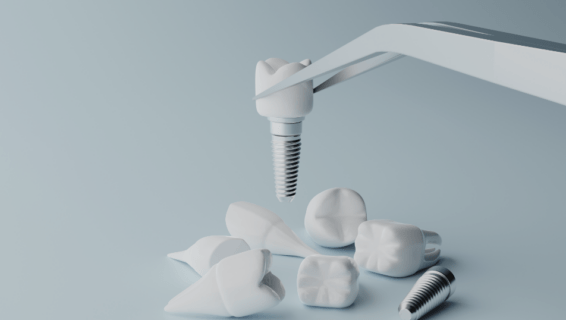 Implantologia – Limed